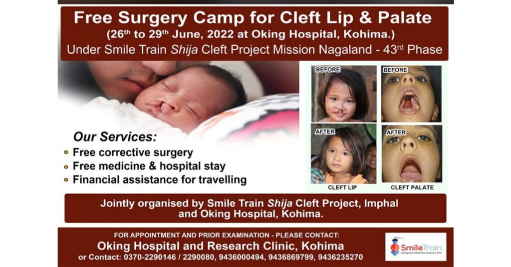 Free surgery camp for cleft lip & palate from June 26 » MokokchungTimes.com